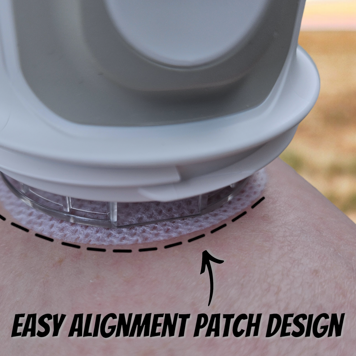 Dexcom G7 : Allergy Underlay Skin Barrier Adhesive Patches – The ...