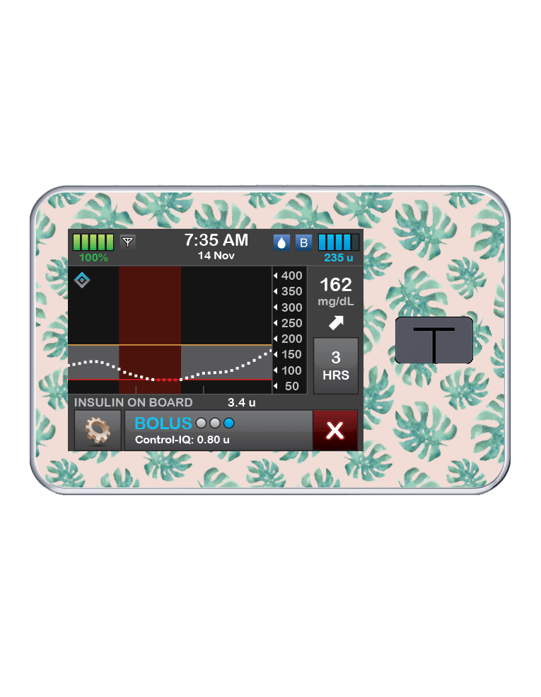 T:slim Cover Sticker (Tropical Vibes) by Diabetic Supply – The Useless ...